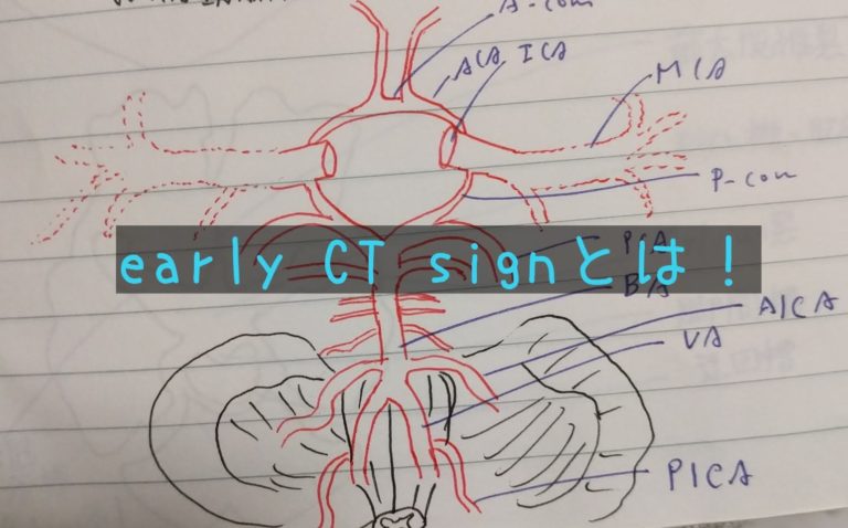 [頭部CT]early CT sign とは何か？原因から画像を考えよう！ - 放射線技師一年目の教科書